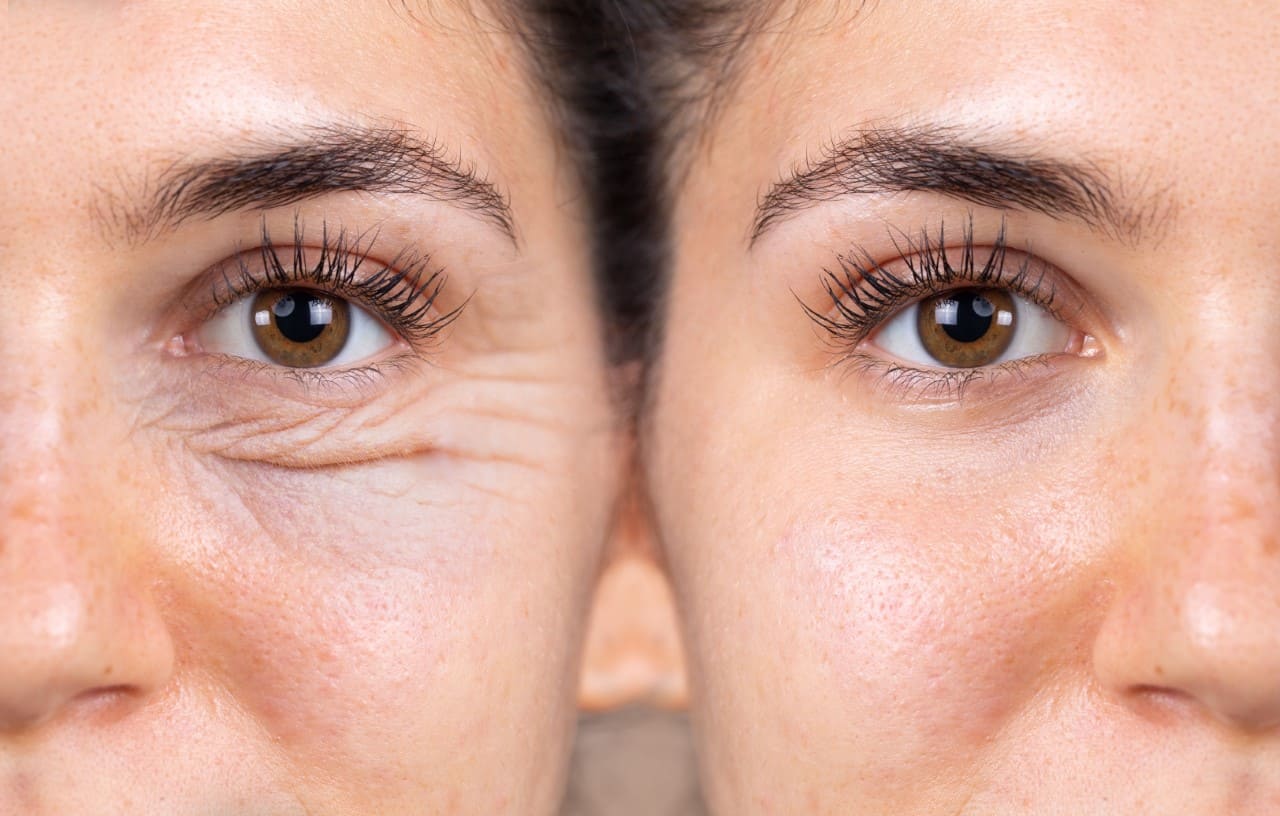 ¿Qué es la Oculoplastia y cuáles son las razones por las que debes ...